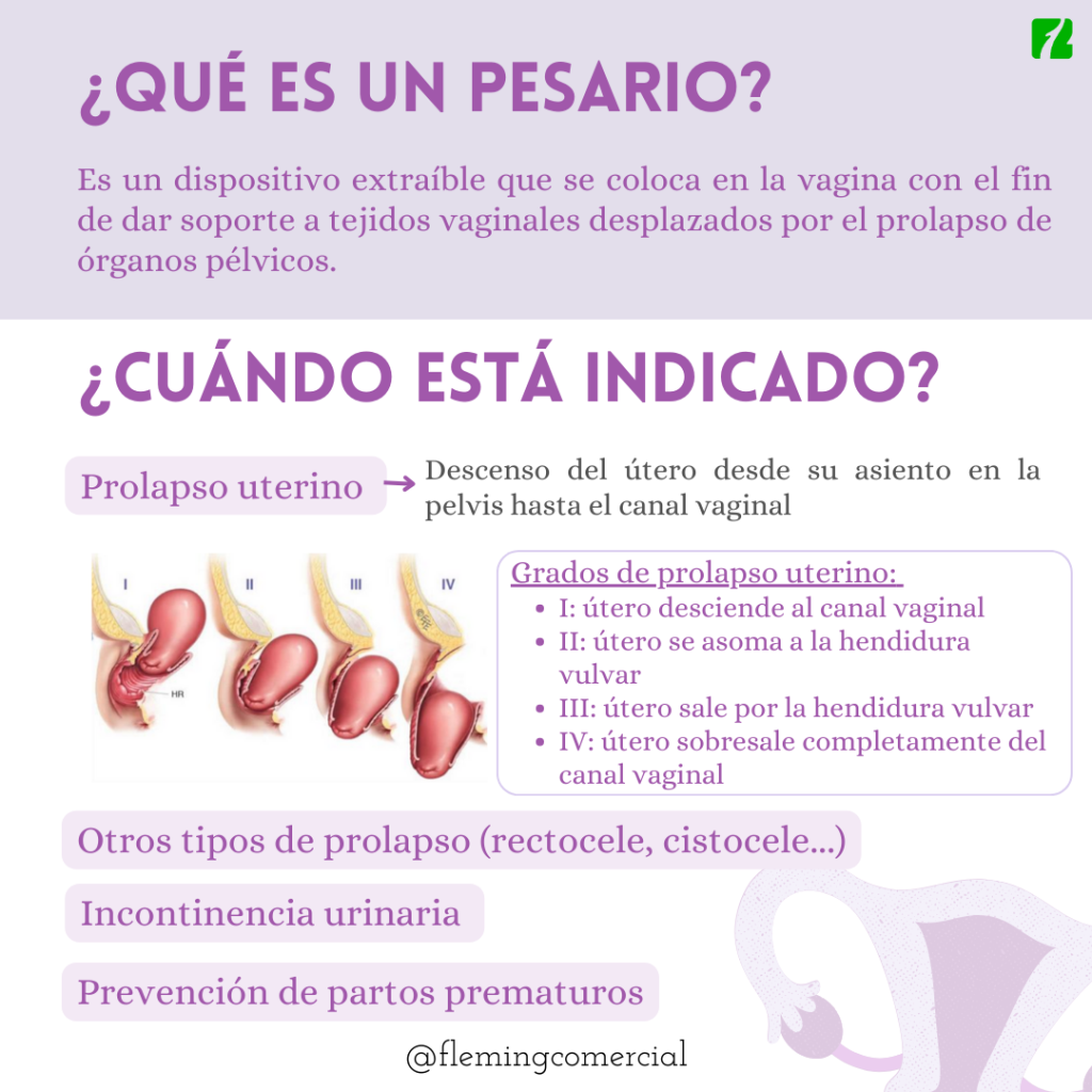 Prolapso Uterino y Pesarios de Silicona - Fleming SA