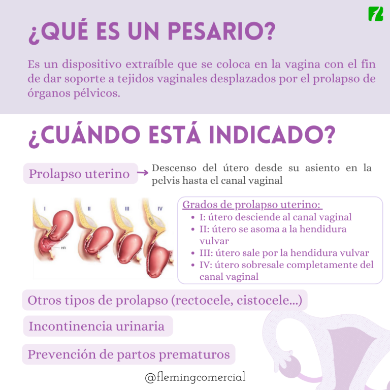 Prolapso Uterino y Pesarios de Silicona - Fleming SA